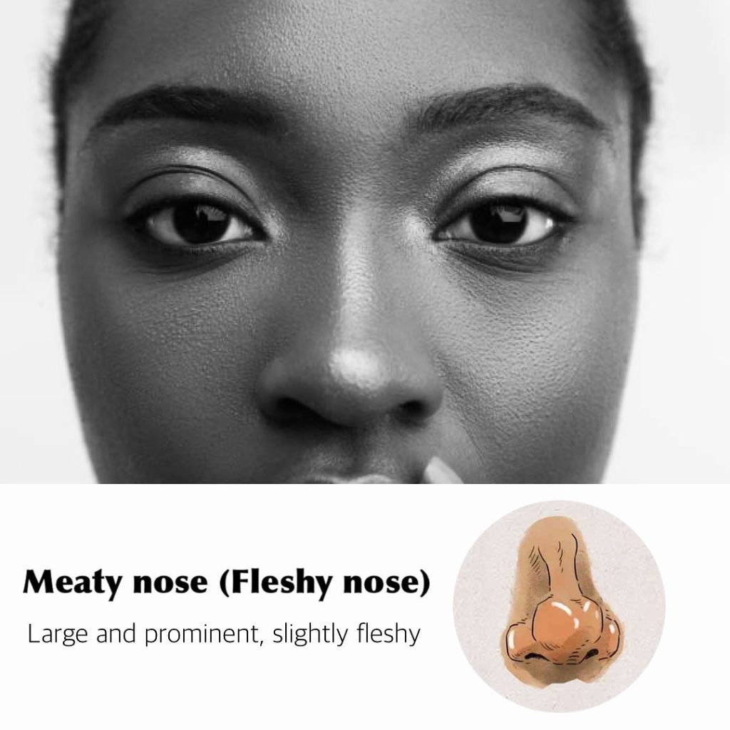 Different noses – دکتر حسام جهاندیده